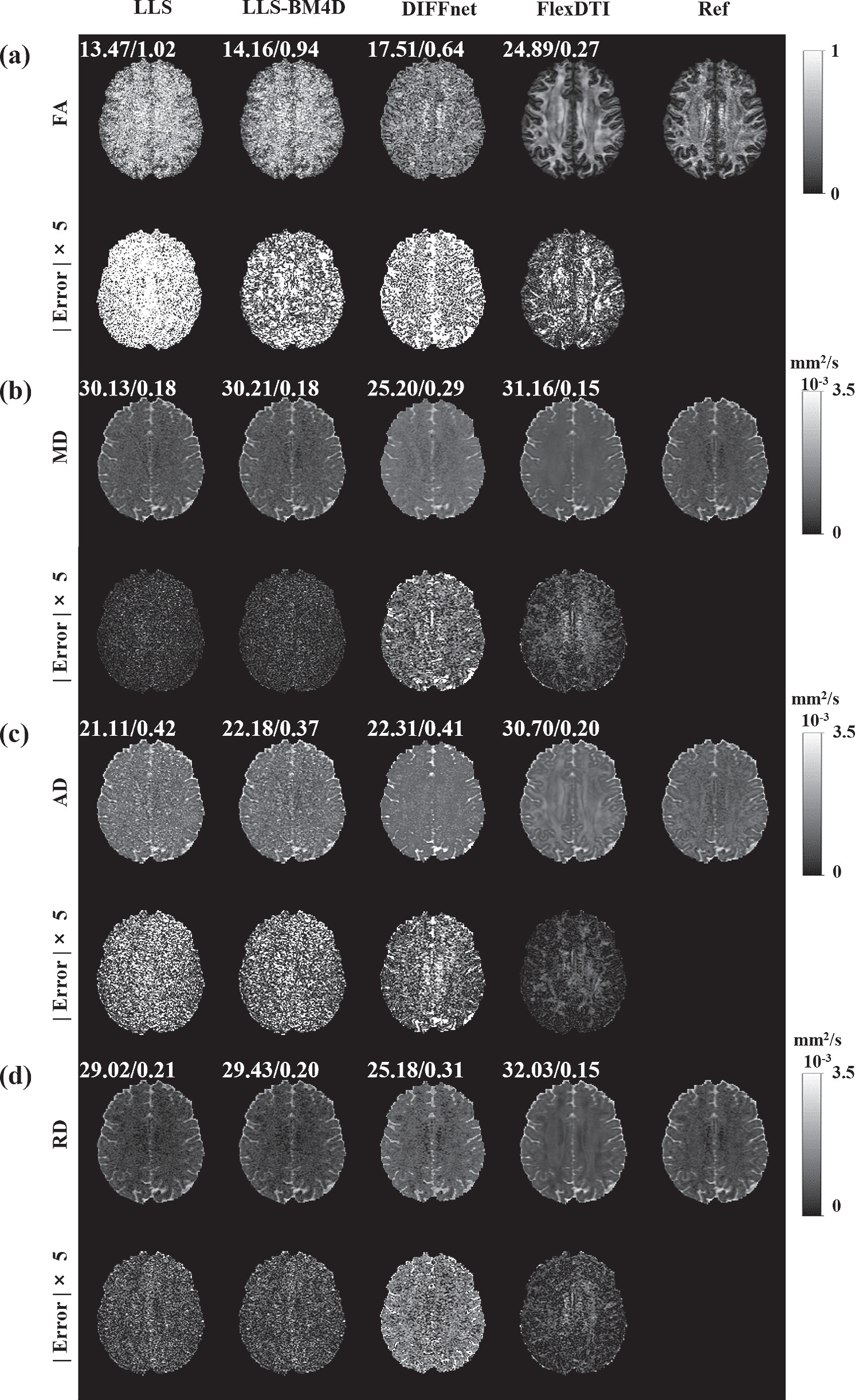 FlexDTI: flexible diffusion gradient encoding scheme-based highly efficient diffusion tensor ...