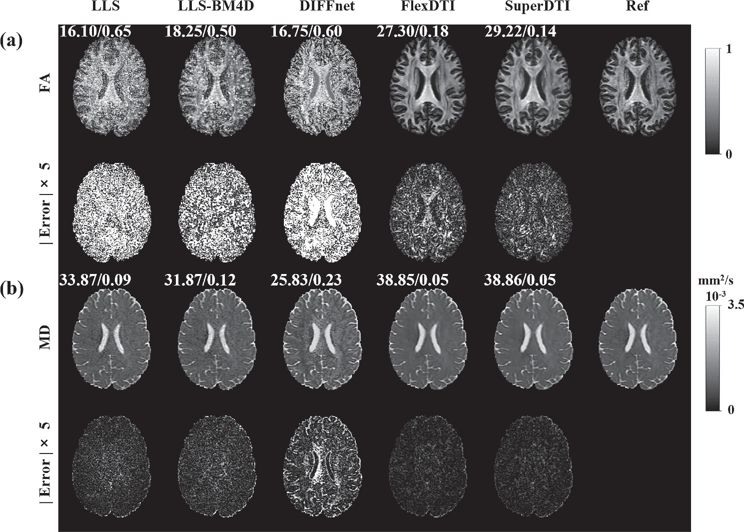 FlexDTI: flexible diffusion gradient encoding scheme-based highly efficient diffusion tensor ...