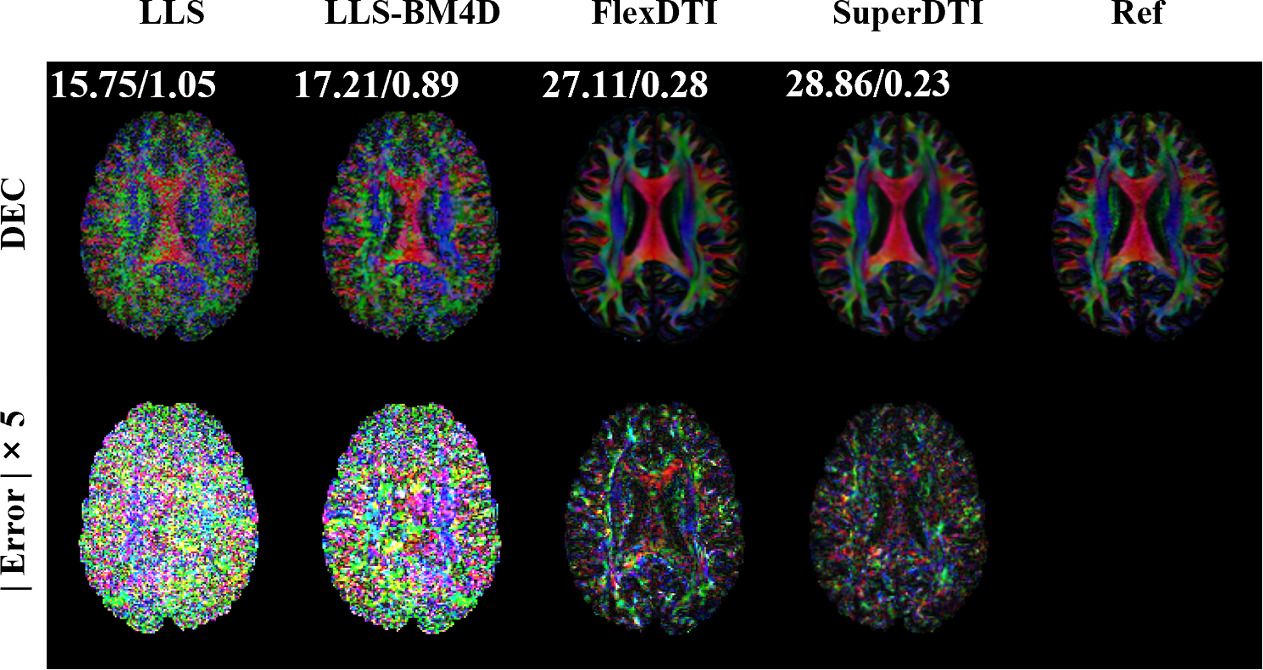 FlexDTI: flexible diffusion gradient encoding scheme-based highly efficient diffusion tensor ...