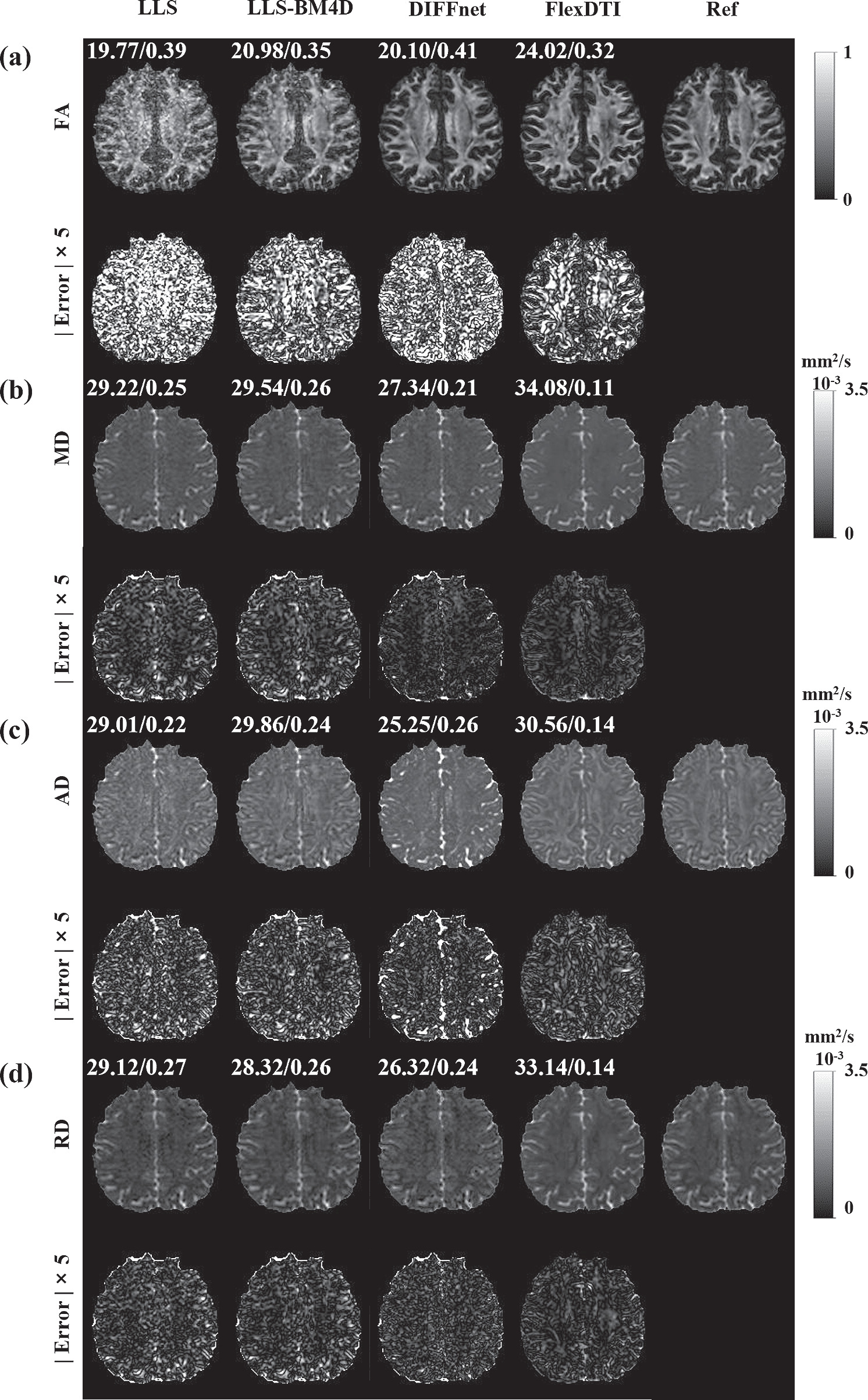 FlexDTI: flexible diffusion gradient encoding scheme-based highly ...