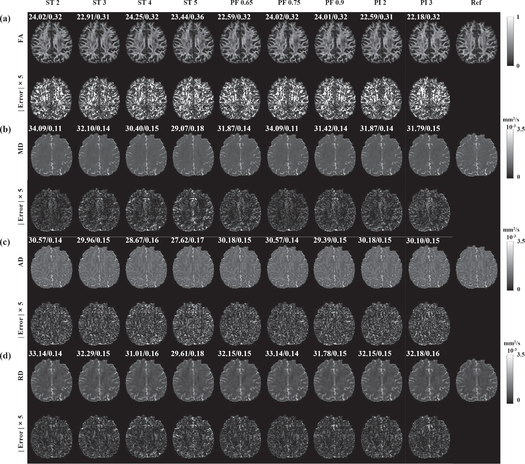 FlexDTI: flexible diffusion gradient encoding scheme-based highly efficient diffusion tensor ...