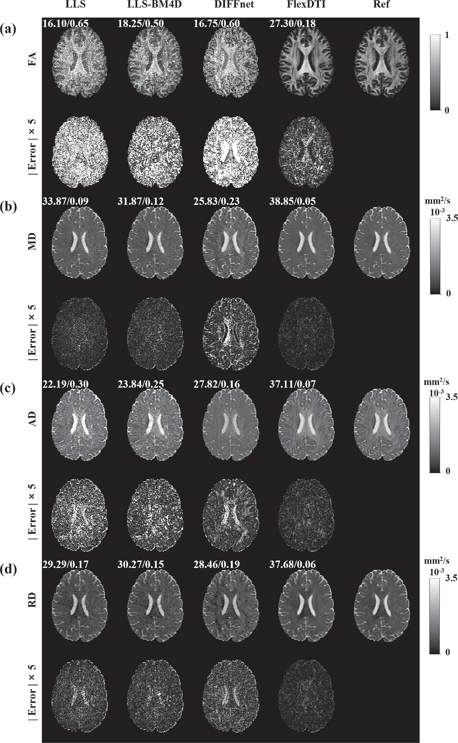 FlexDTI: flexible diffusion gradient encoding scheme-based highly ...