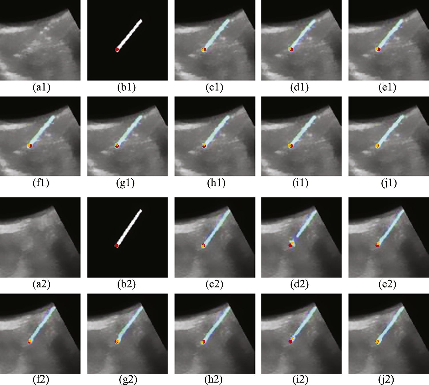 A temporal enhanced semi-supervised training framework for needle ...