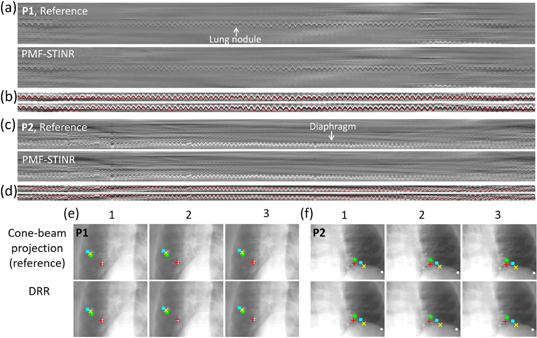 Dynamic CBCT imaging using prior model-free spatiotemporal implicit ...
