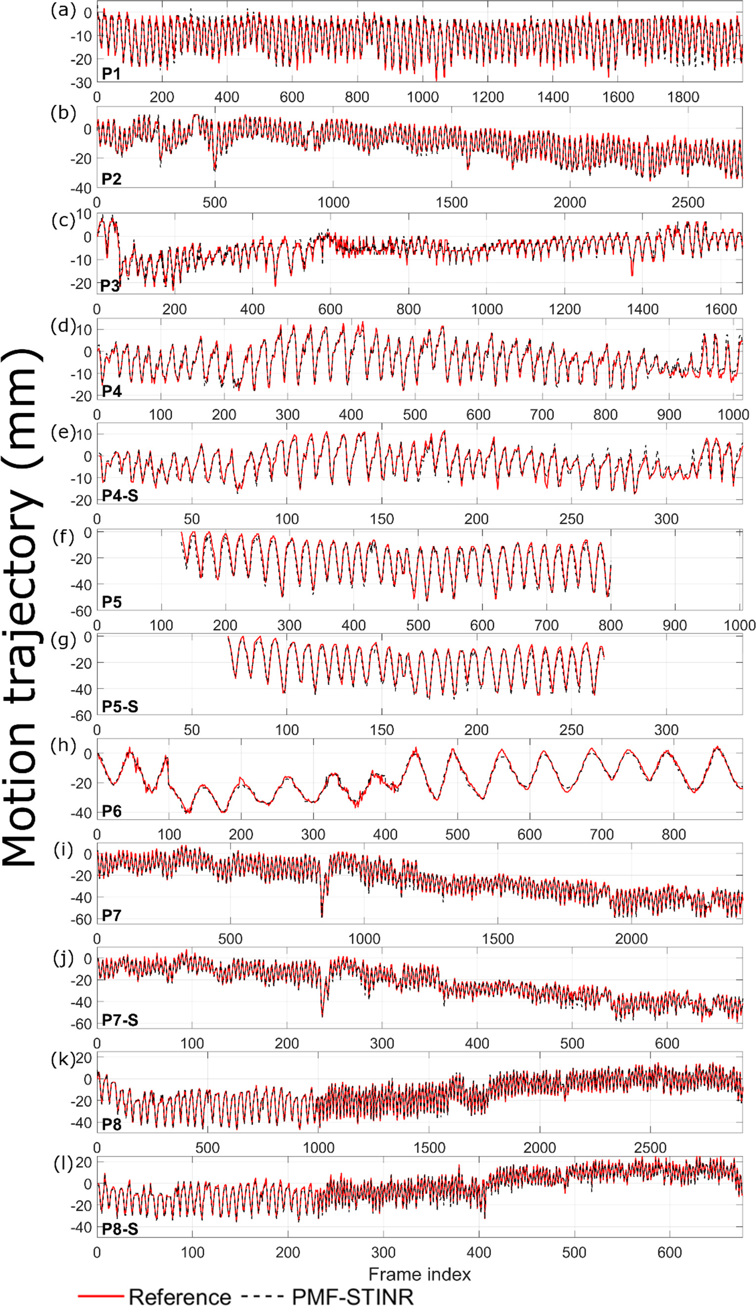 Dynamic CBCT imaging using prior model-free spatiotemporal implicit neural representation (PMF ...