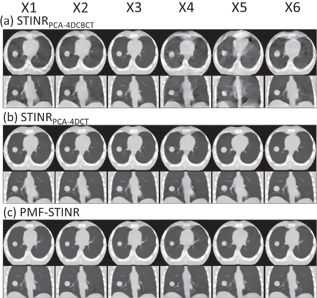Dynamic CBCT imaging using prior model-free spatiotemporal implicit ...
