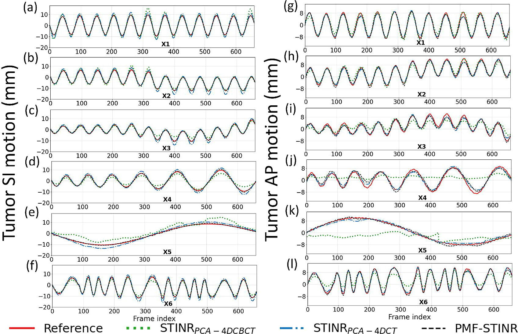Dynamic CBCT imaging using prior model-free spatiotemporal implicit ...