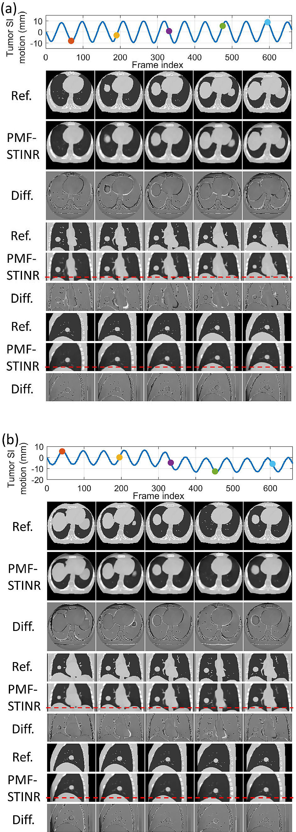 Dynamic CBCT imaging using prior model-free spatiotemporal implicit ...