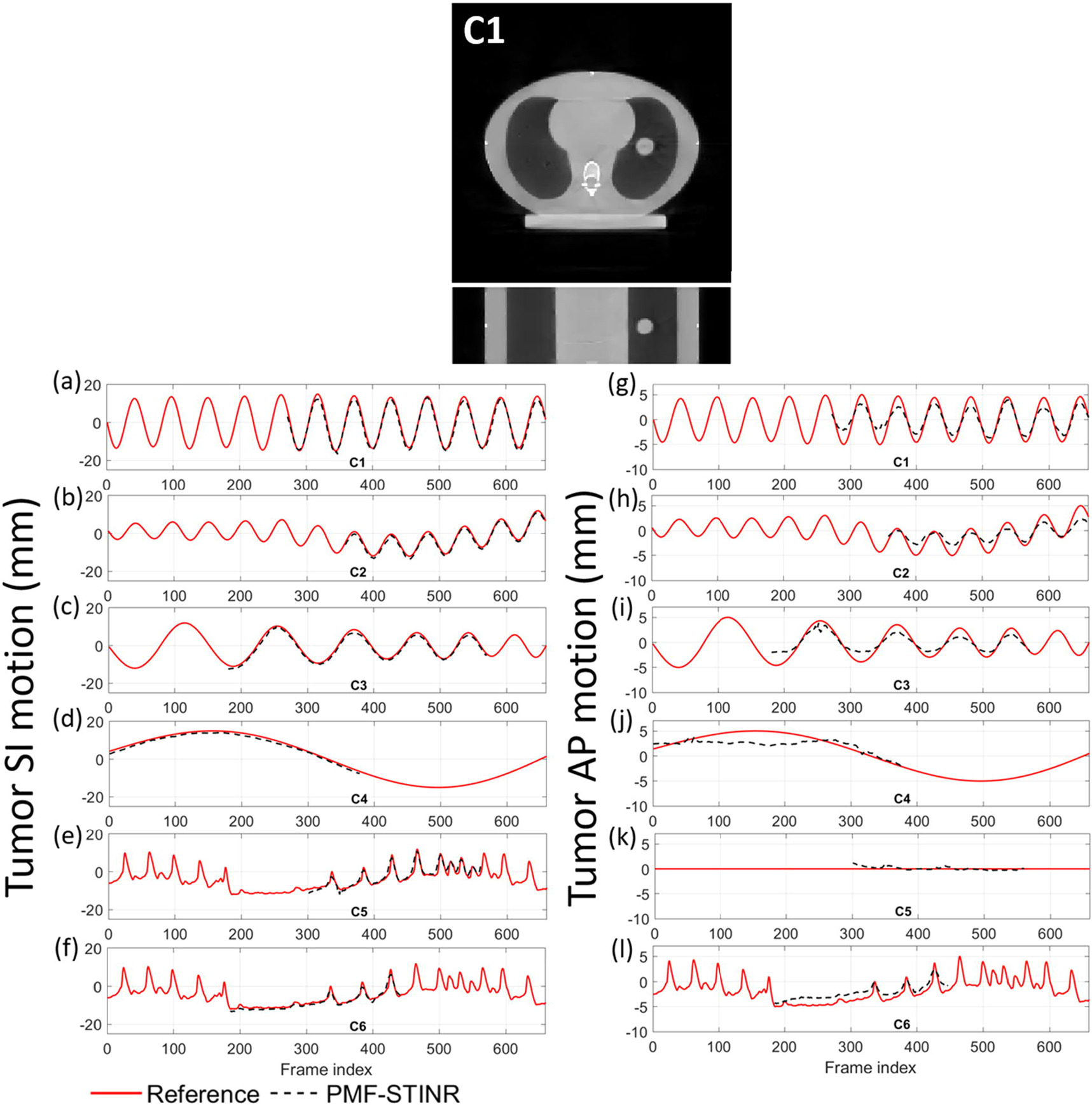 Dynamic CBCT imaging using prior model-free spatiotemporal implicit ...
