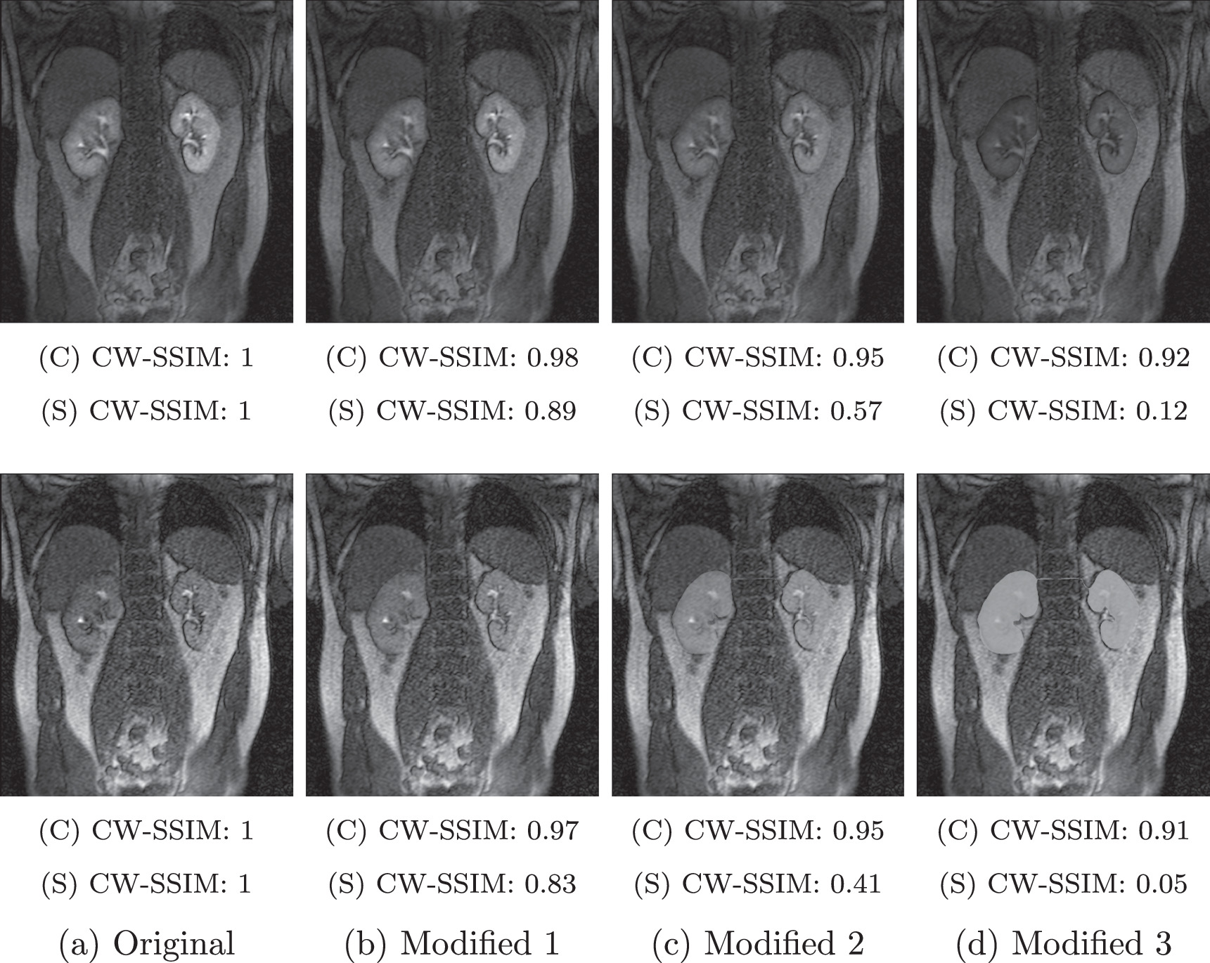 TIST-Net: style transfer in dynamic contrast enhanced MRI using spatial ...