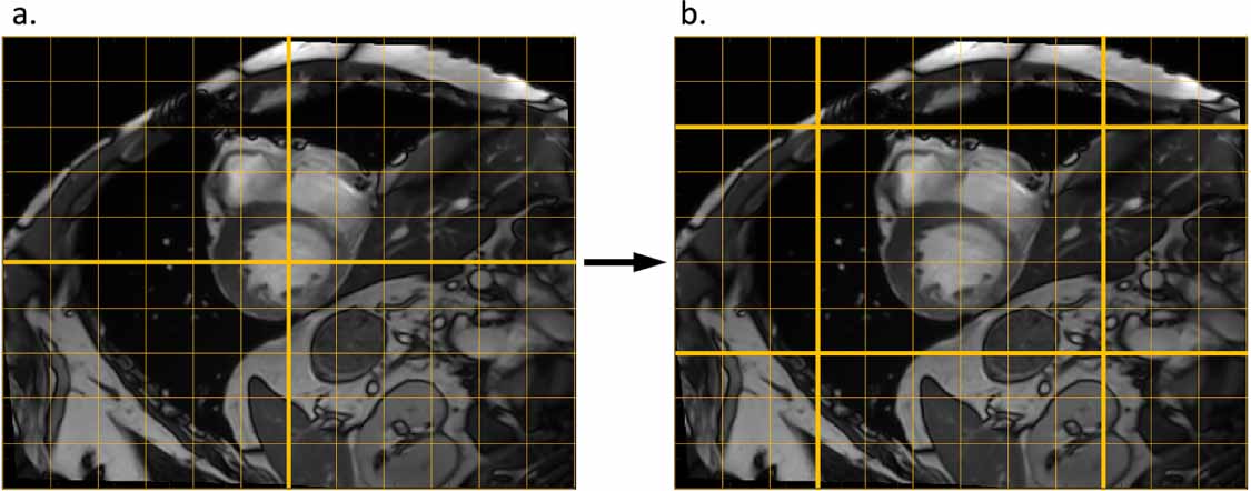Cardiac MRI segmentation using shifted-window multilayer perceptron ...