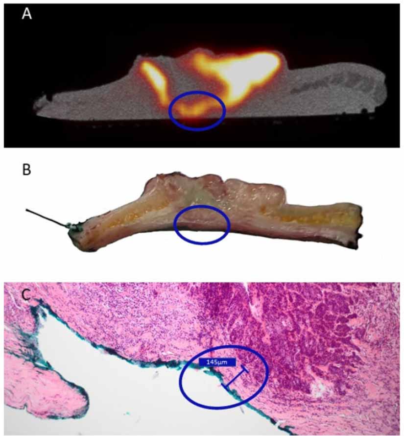 Innovations in dedicated PET instrumentation: from the operating room ...