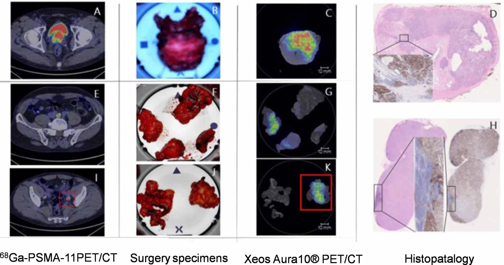 Innovations in dedicated PET instrumentation: from the operating room ...