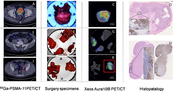 Innovations in dedicated PET instrumentation: from the operating room ...