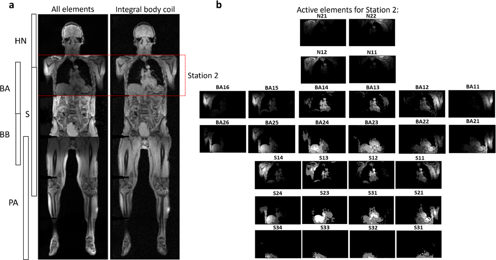 A scan-specific quality control acquisition for clinical whole-body (WB ...