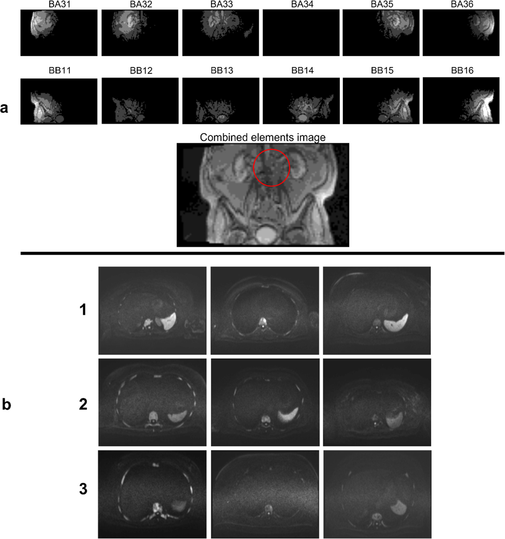 A scan-specific quality control acquisition for clinical whole-body (WB ...