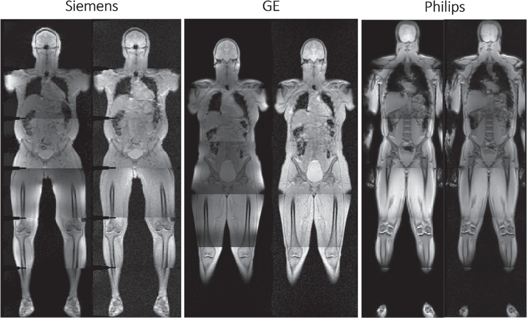 A scan-specific quality control acquisition for clinical whole-body (WB ...
