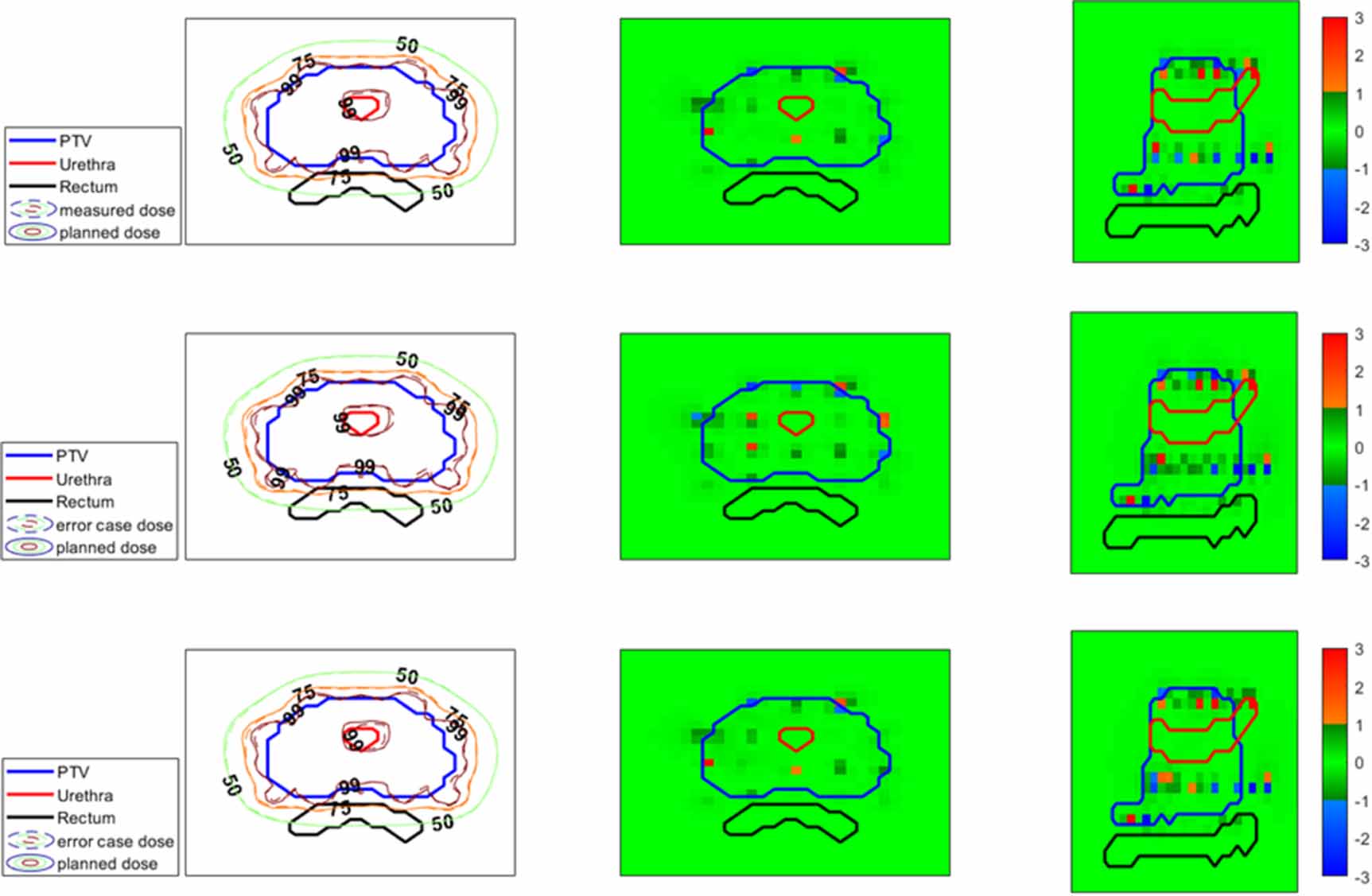Time-resolved clinical dose volume metrics, calculations and ...