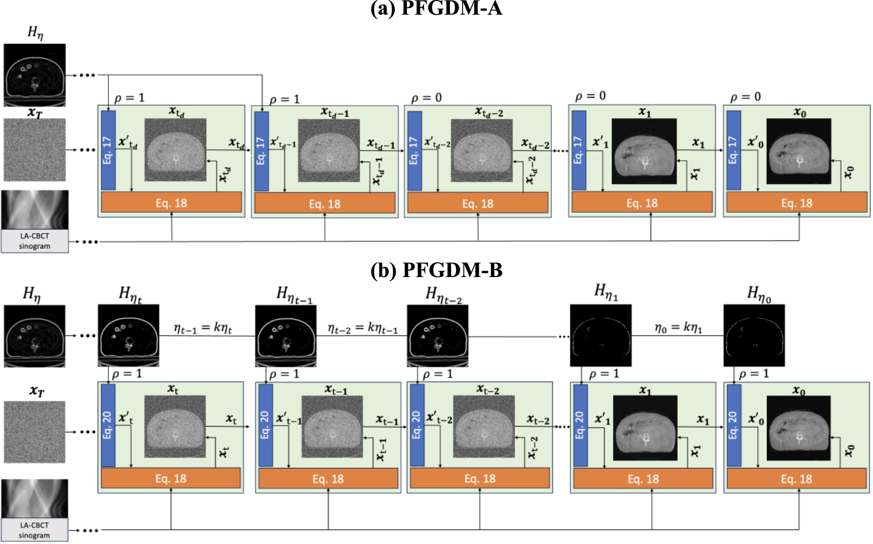 Prior frequency guided diffusion model for limited angle (LA)-CBCT ...
