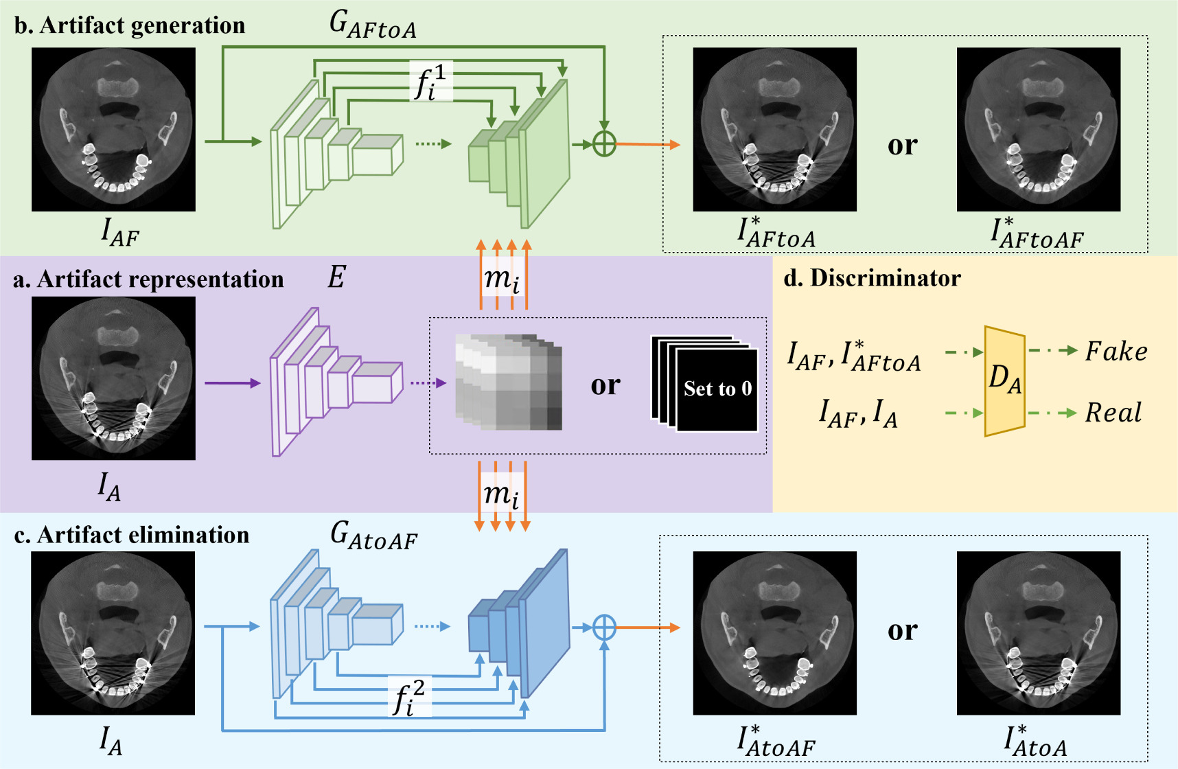 b-MAR: bidirectional artifact representations learning framework for ...