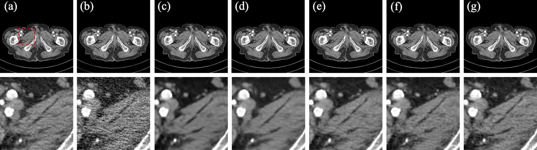 Structure-aware diffusion for low-dose CT imaging - IOPscience