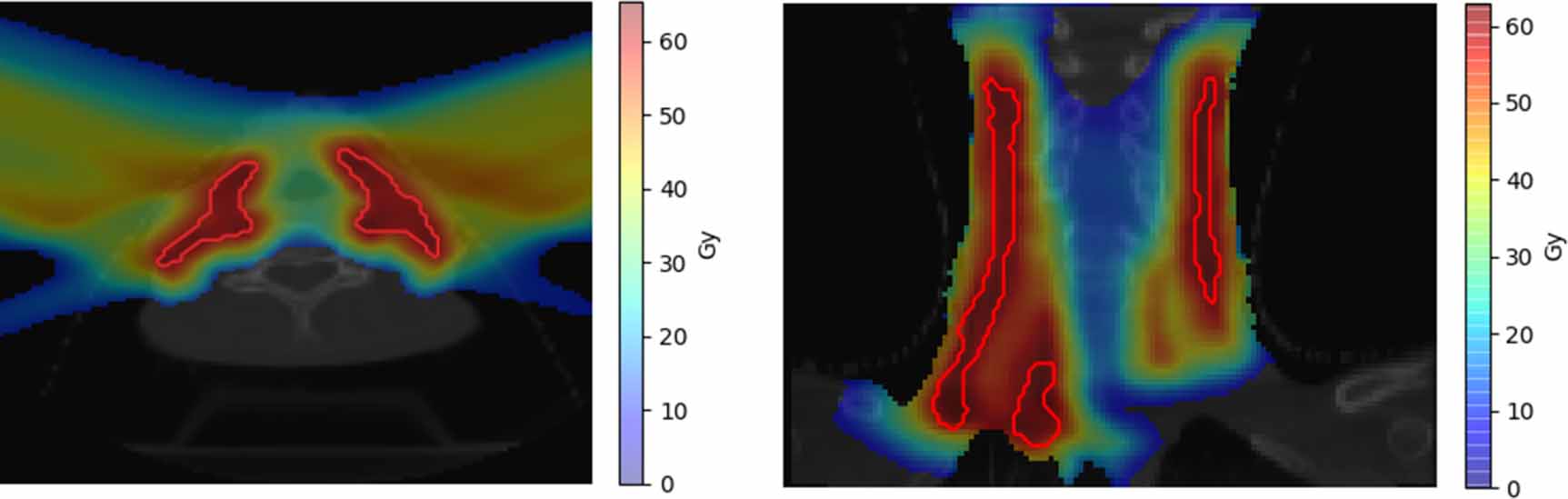 DiffuseRT: predicting likely anatomical deformations of patients ...