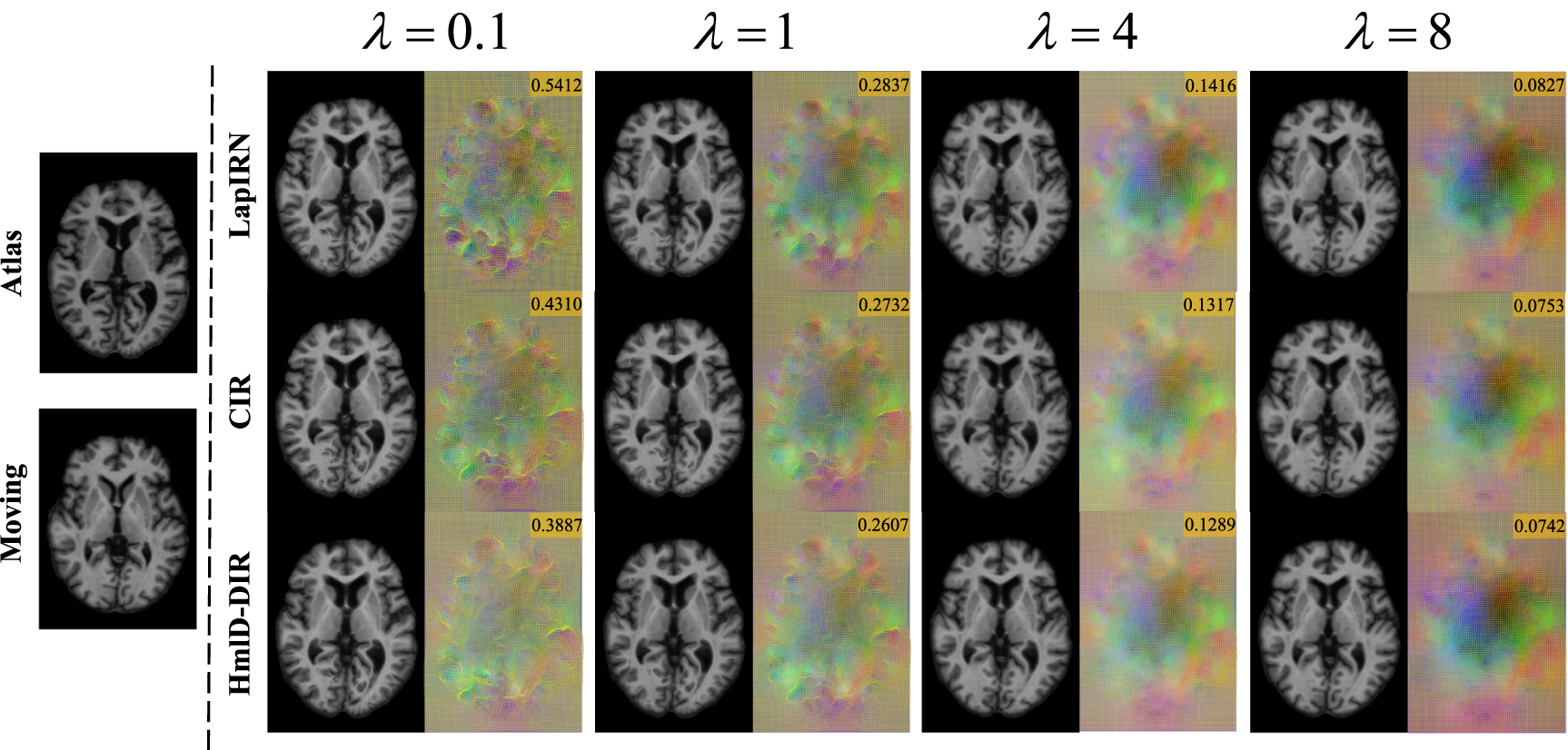 Hierarchical multi-level dynamic hyperparameter deformable image registration with convolutional ...