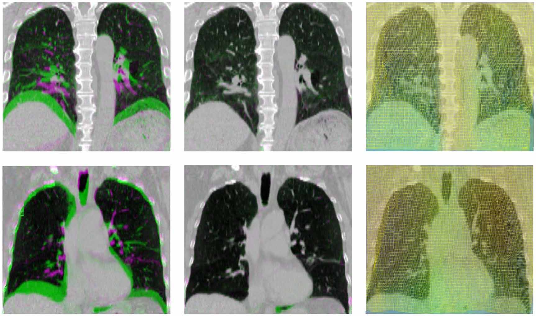 Hierarchical multi-level dynamic hyperparameter deformable image registration with convolutional ...