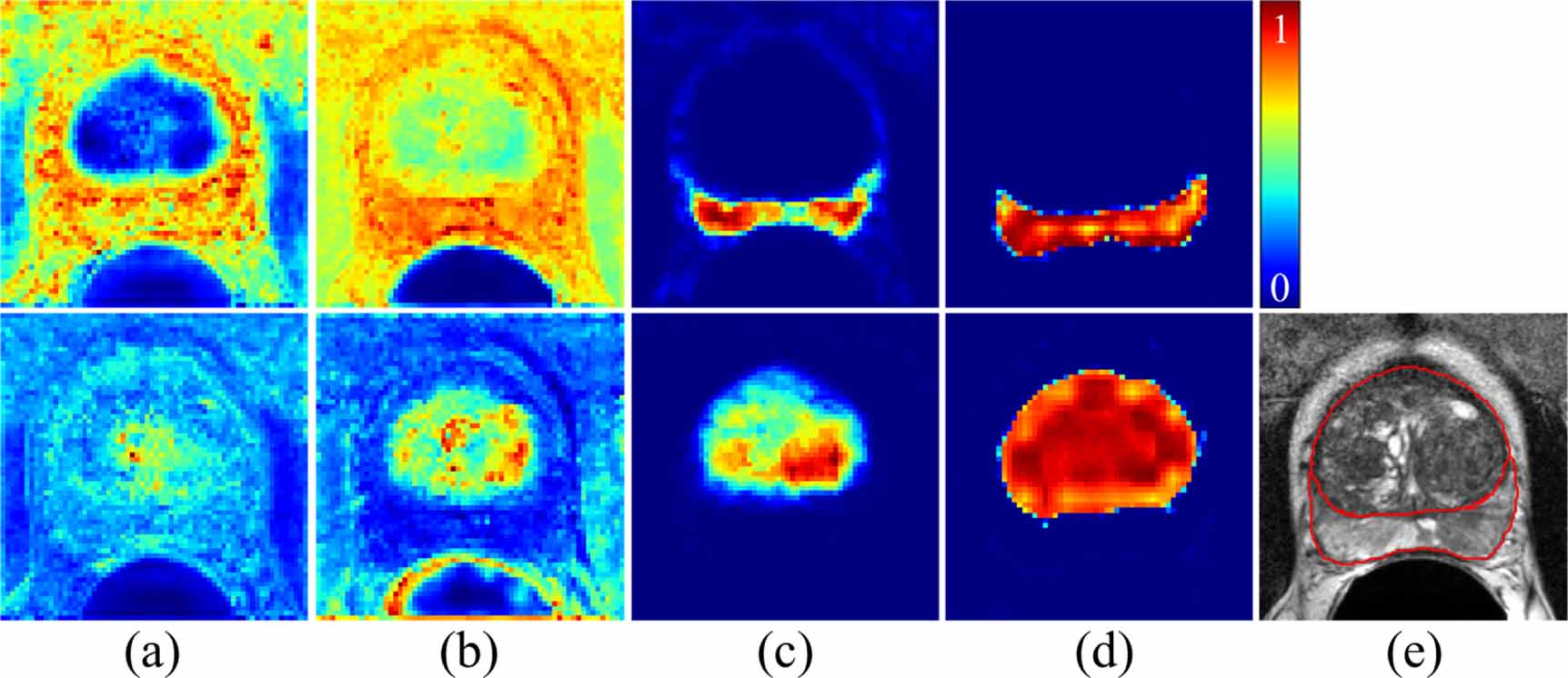 Boundary-aware semantic clustering network for segmentation of prostate ...