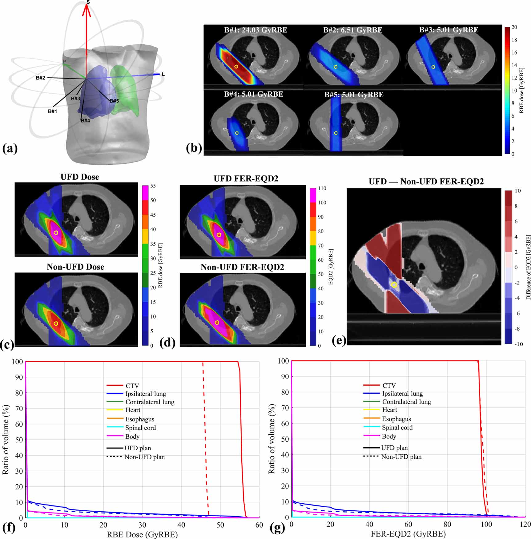 Fractionation dose optimization facilities the implementation of ...