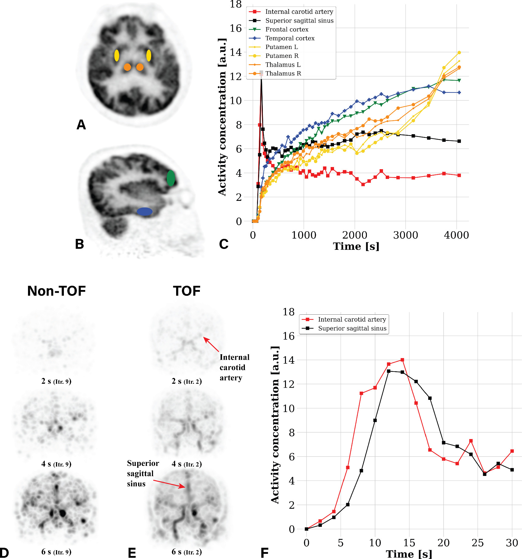 Development and evaluation of a new high-TOF-resolution all-digital ...