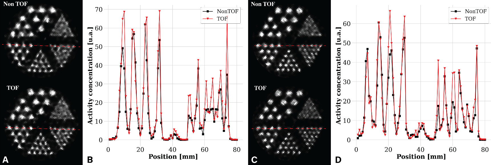 Development and evaluation of a new high-TOF-resolution all-digital ...