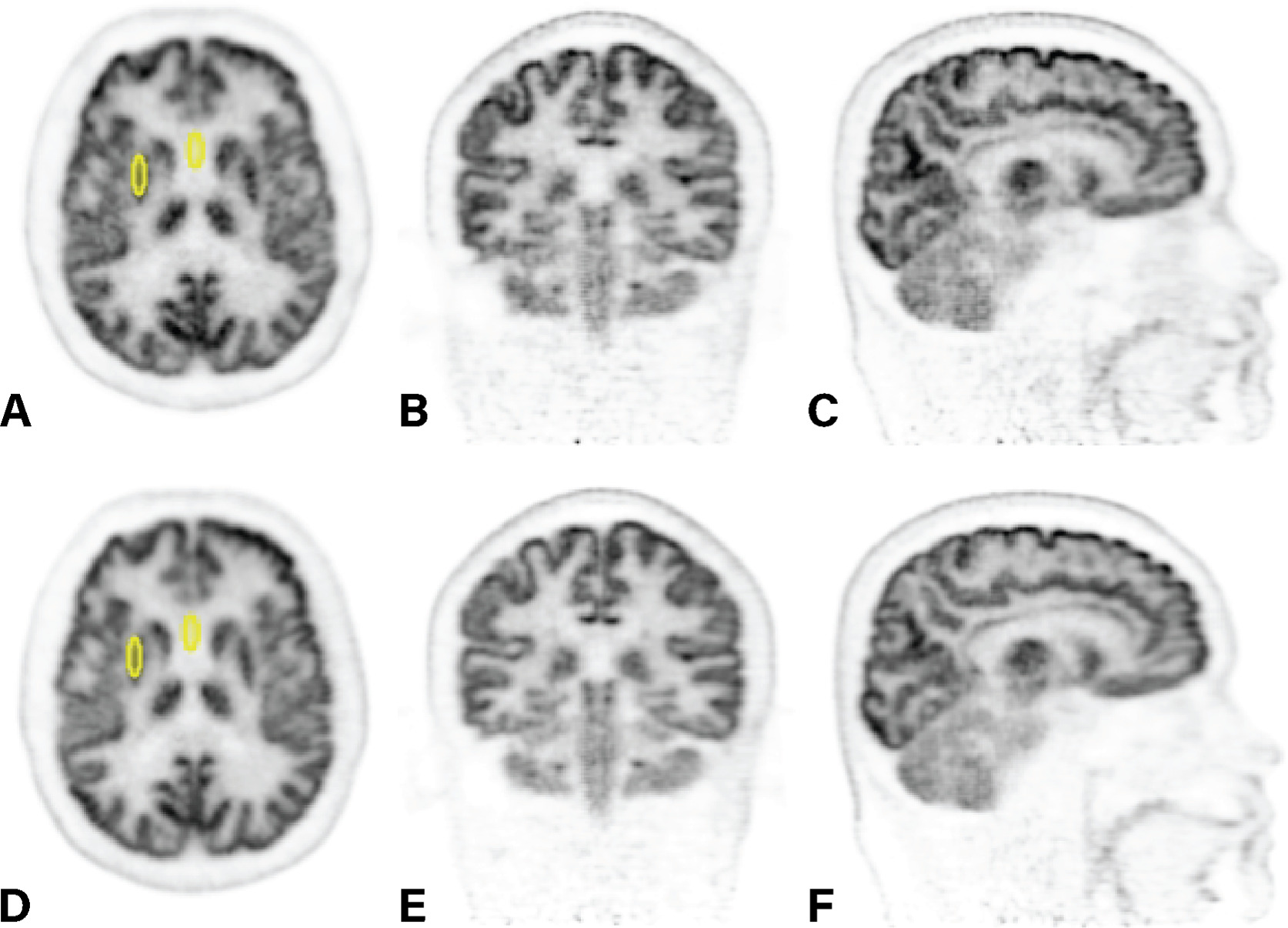 Development and evaluation of a new high-TOF-resolution all-digital ...