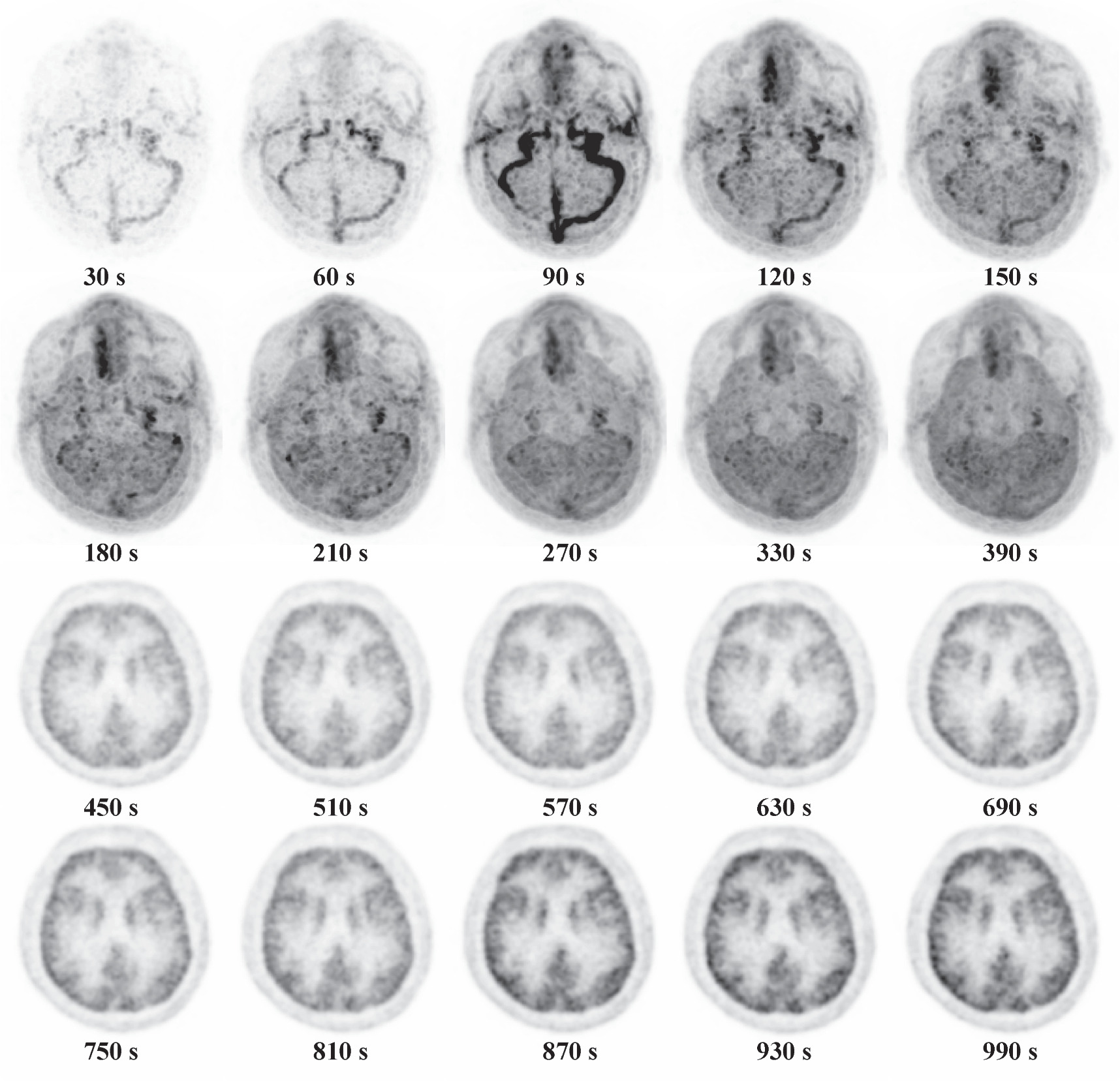 Development and evaluation of a new high-TOF-resolution all-digital ...