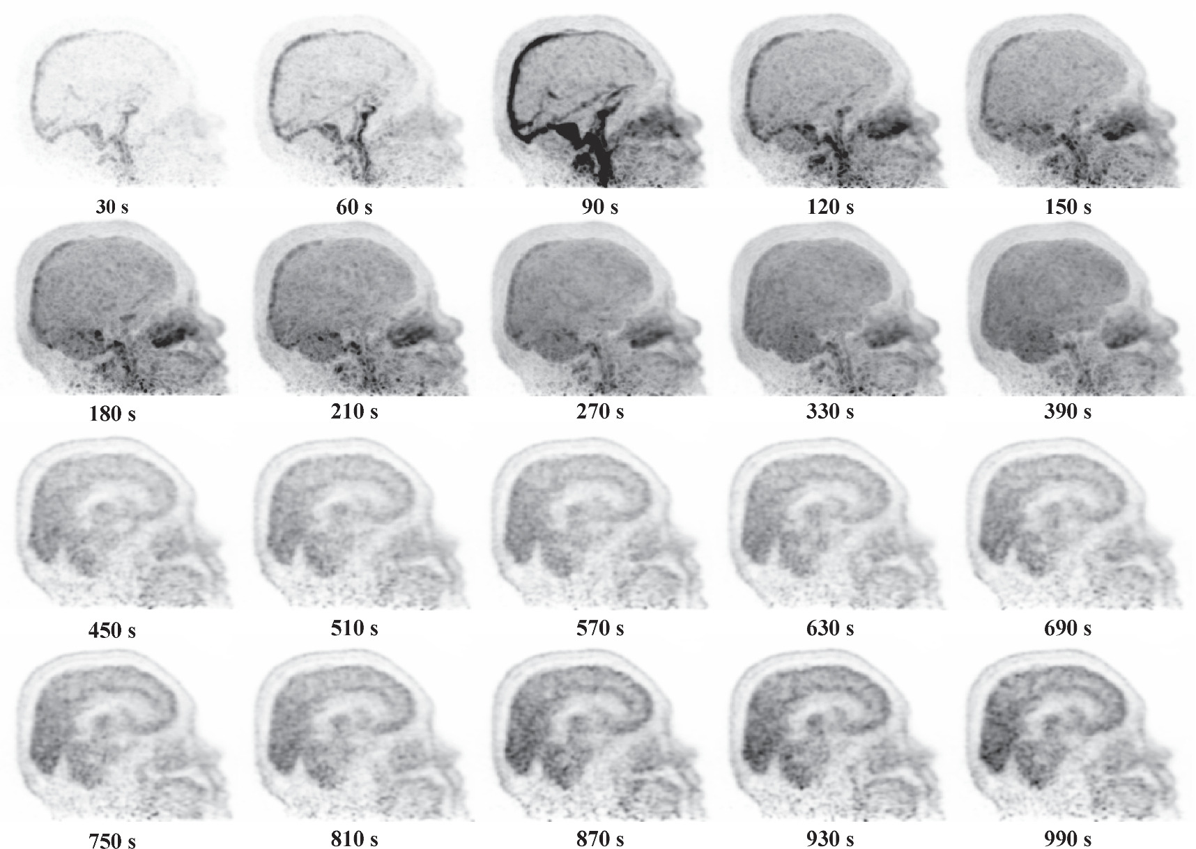 Development and evaluation of a new high-TOF-resolution all-digital ...