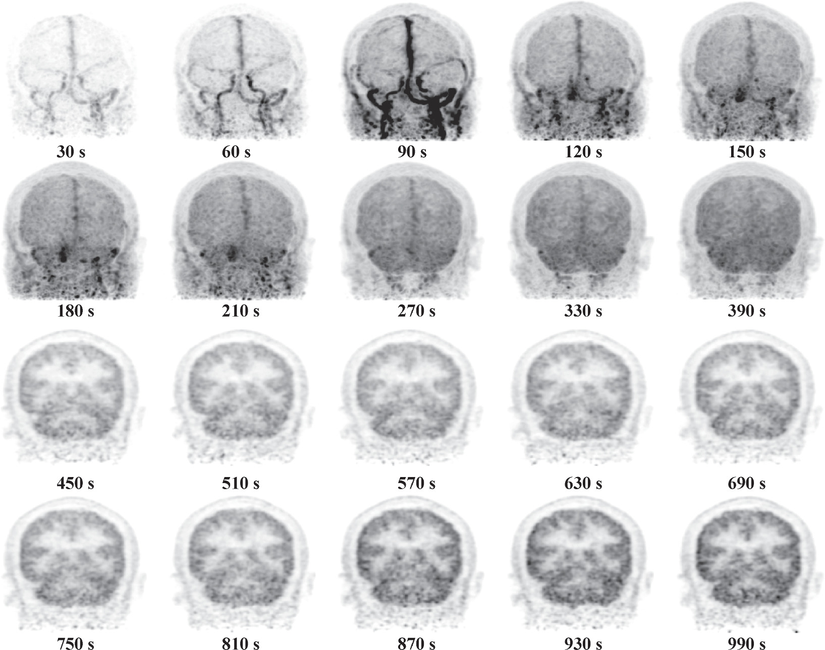Development and evaluation of a new high-TOF-resolution all-digital ...