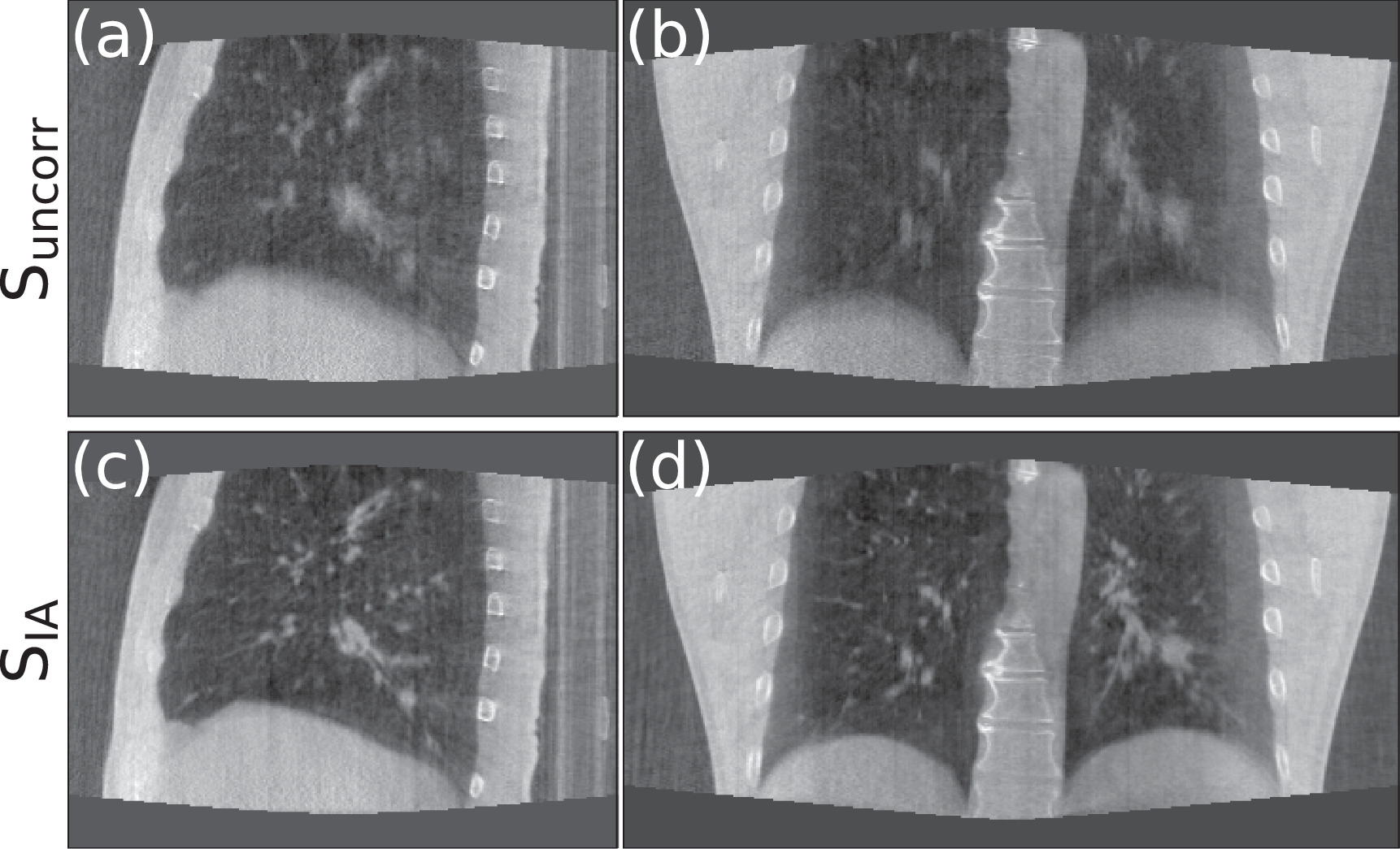 Surrogate-driven respiratory motion model for projection-resolved ...