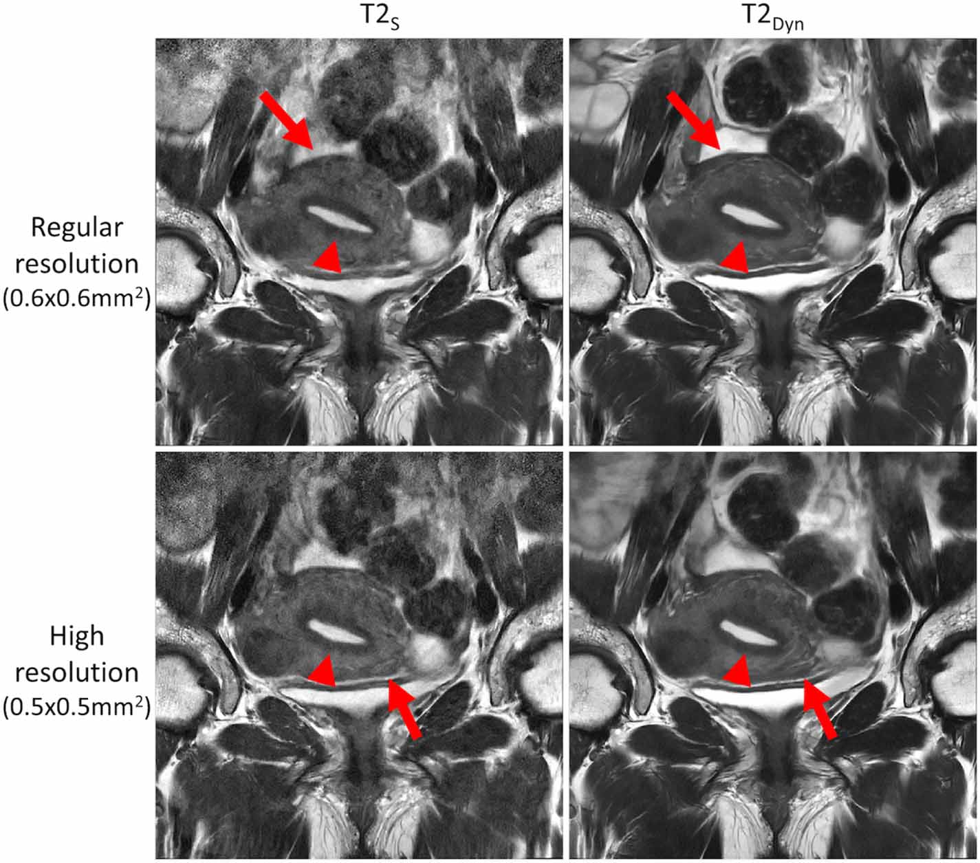 A dynamic approach for MR T2-weighted pelvic imaging - IOPscience