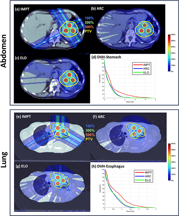 Proton ARC based LATTICE radiation therapy: feasibility study, energy ...
