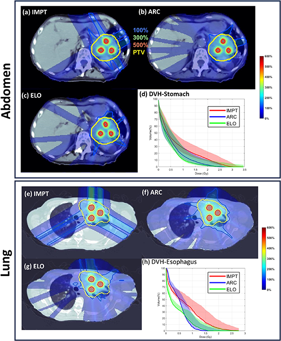 Proton ARC based LATTICE radiation therapy: feasibility study, energy ...