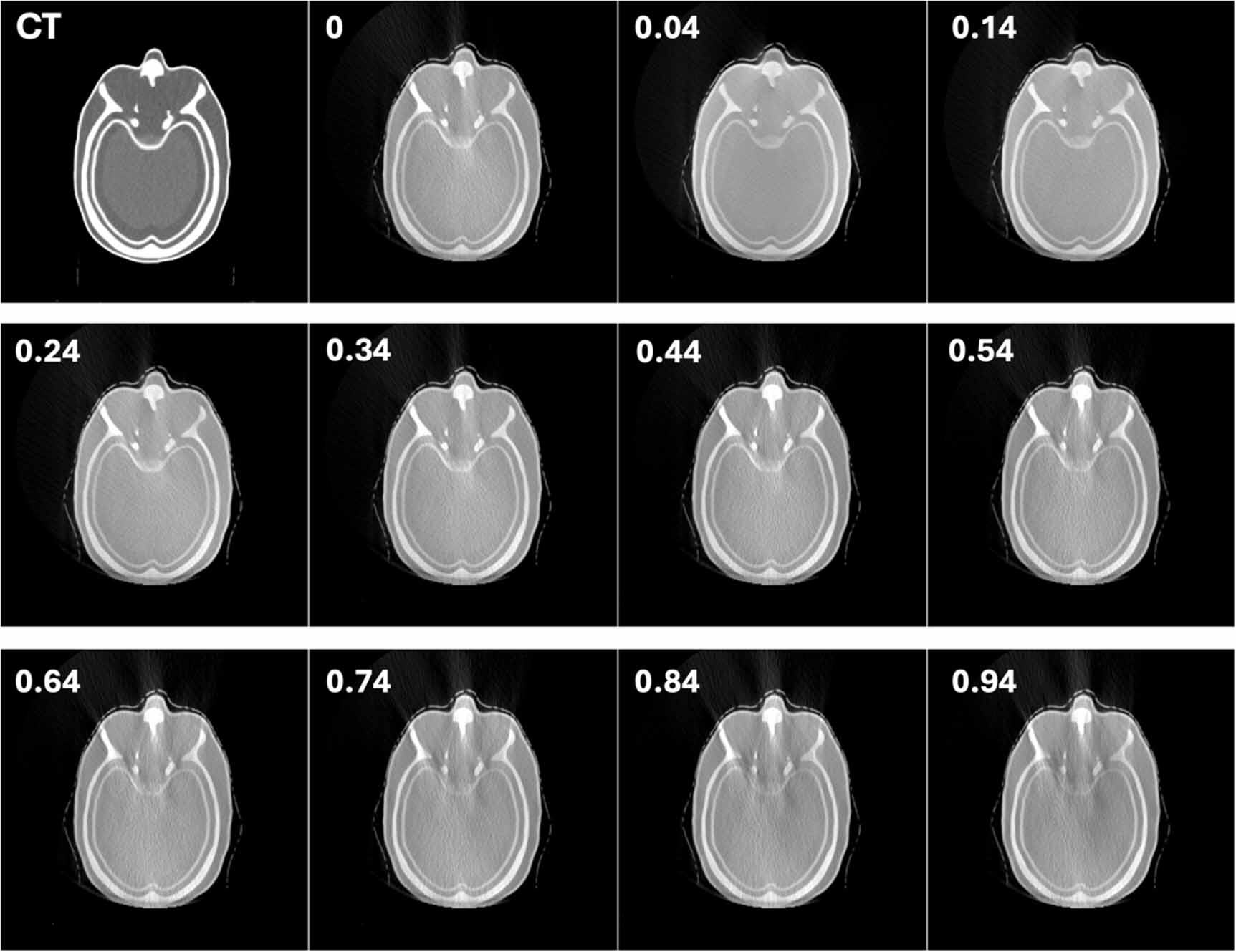 Optimisation of cone beam CT radiotherapy imaging protocols using a ...