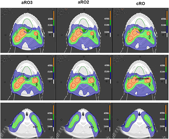 Robust optimization incorporating weekly predicted anatomical CTs in ...