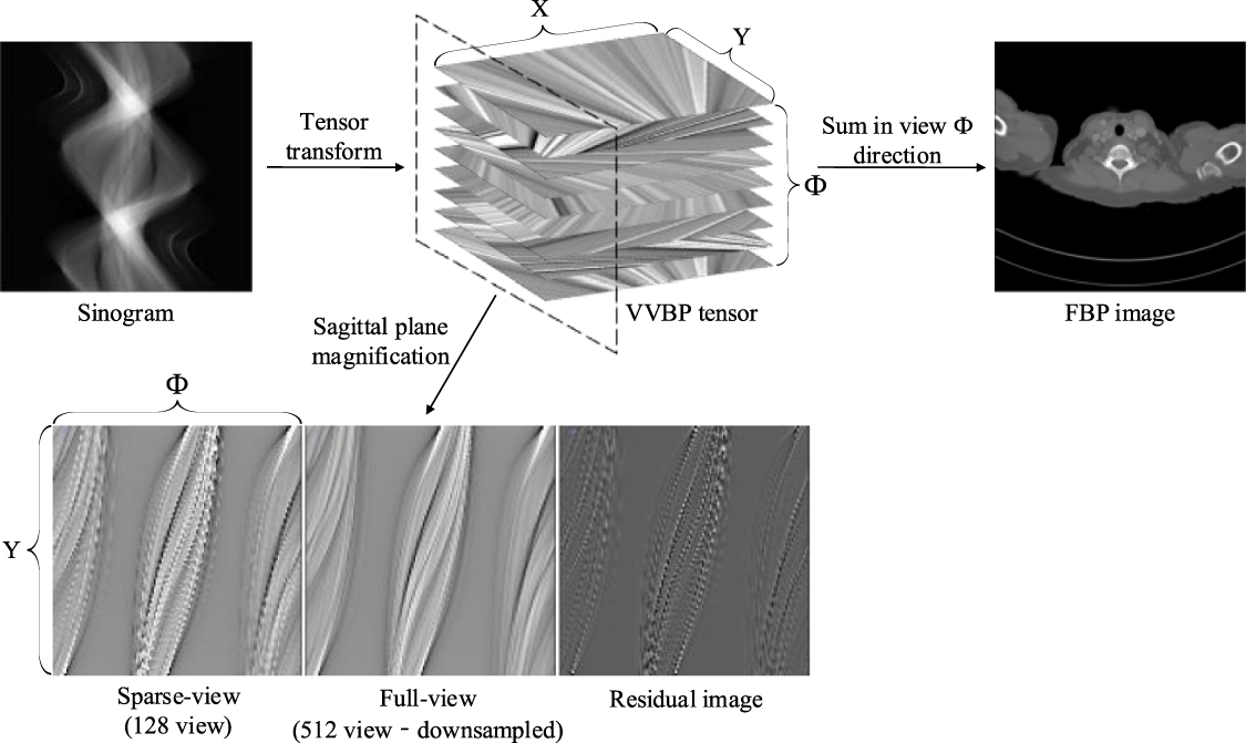 TMAA-net: tensor-domain multi-planal anti-aliasing network for sparse ...