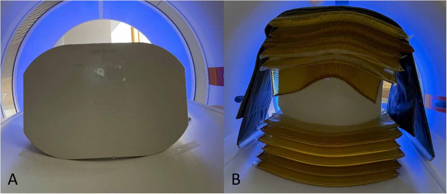 Quantitative assessment of areal bone mineral density using multi ...
