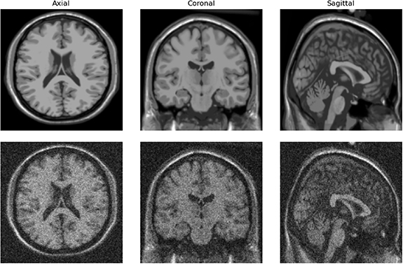 Deep learning methods for 3D magnetic resonance image denoising, bias ...