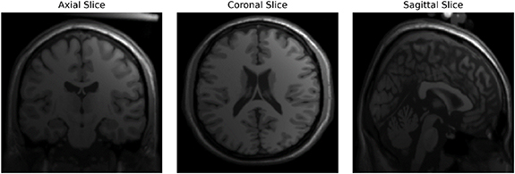 Deep learning methods for 3D magnetic resonance image denoising, bias ...