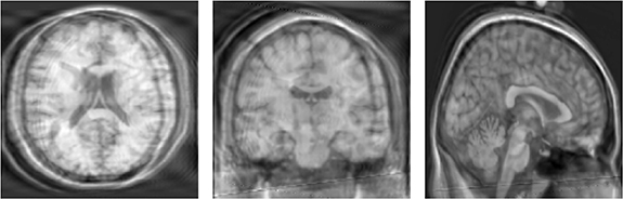 Deep learning methods for 3D magnetic resonance image denoising, bias ...