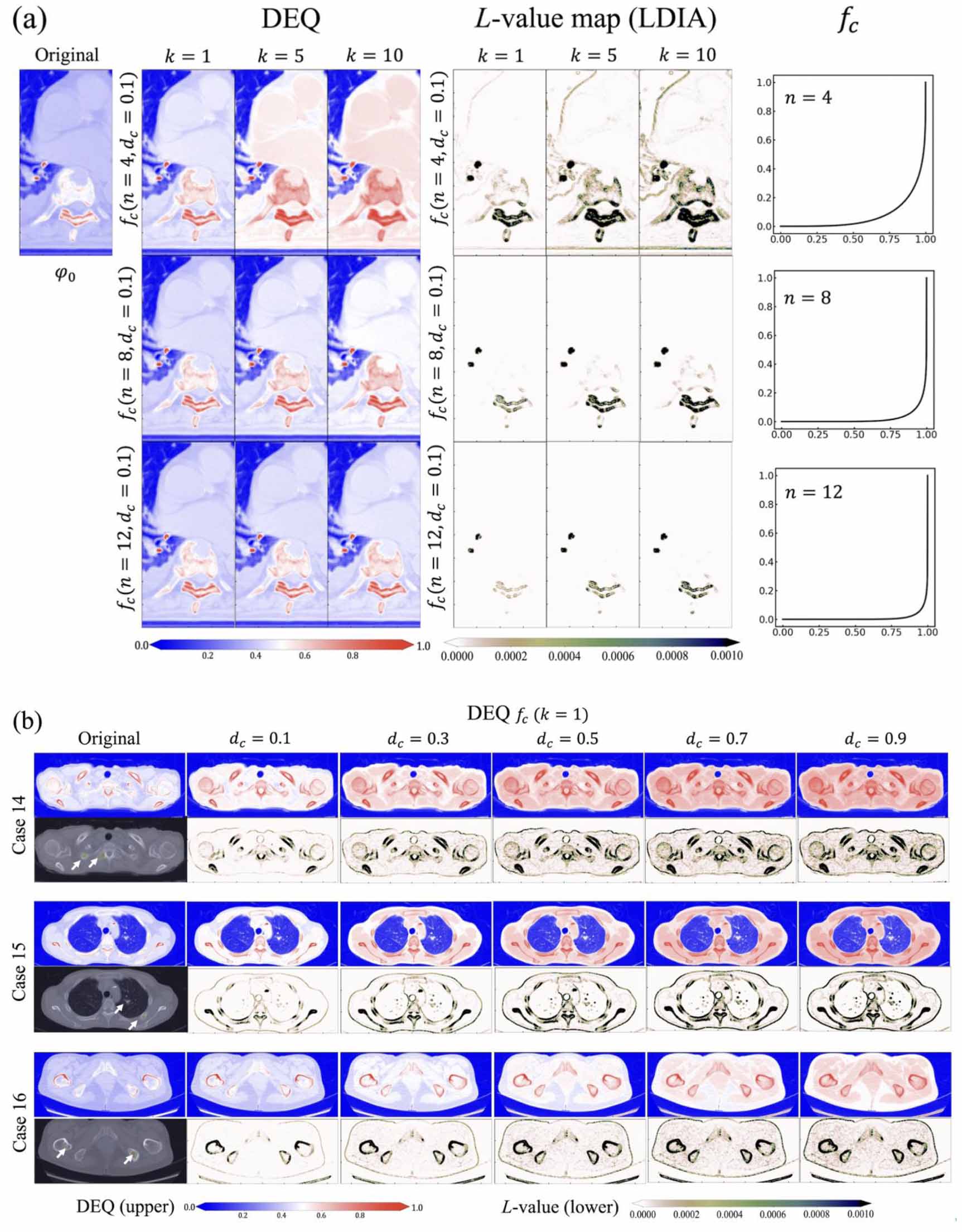 Diffusion equation quantification: selective enhancement algorithm for bone metastasis lesions ...