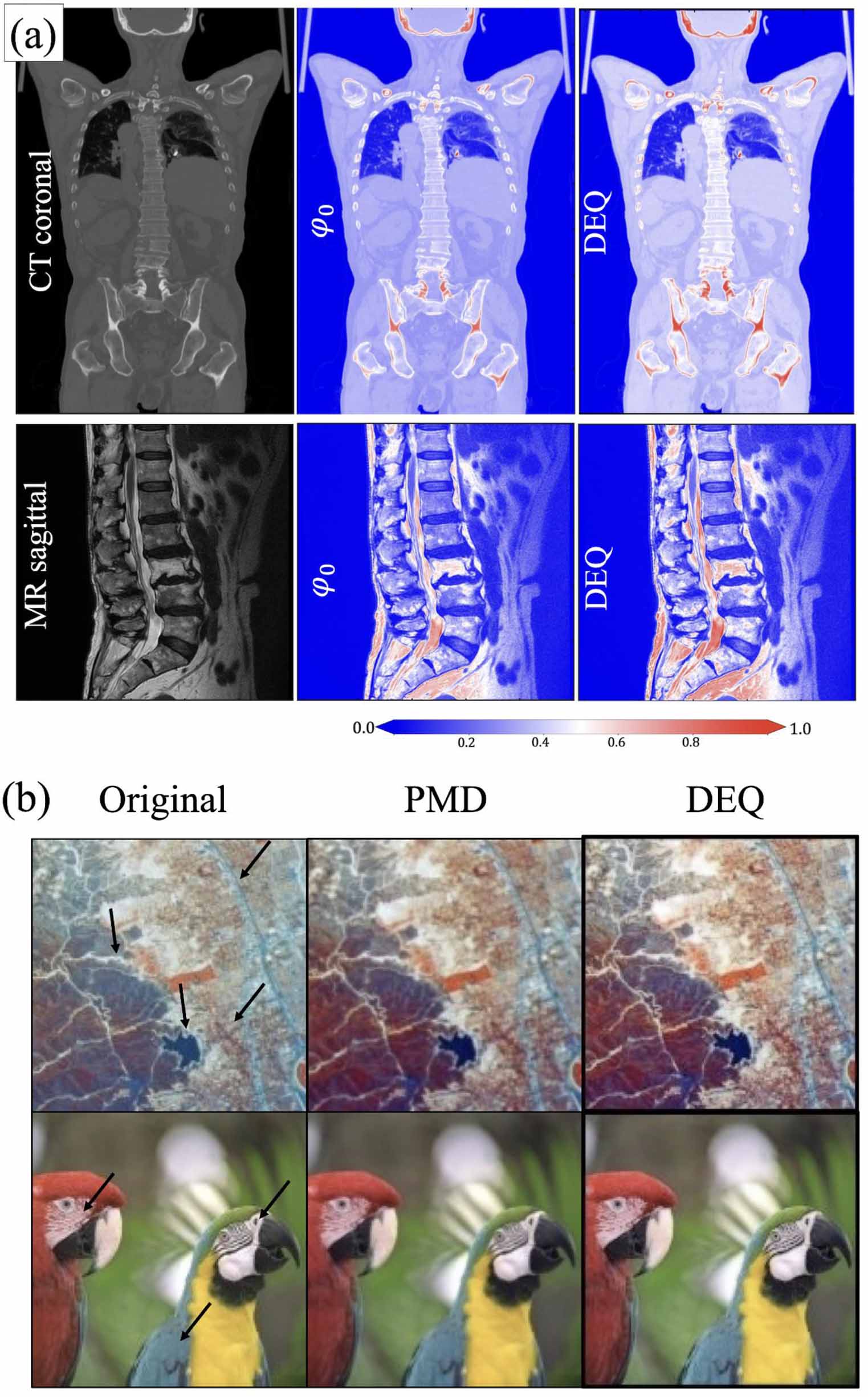 Diffusion equation quantification: selective enhancement algorithm for bone metastasis lesions ...