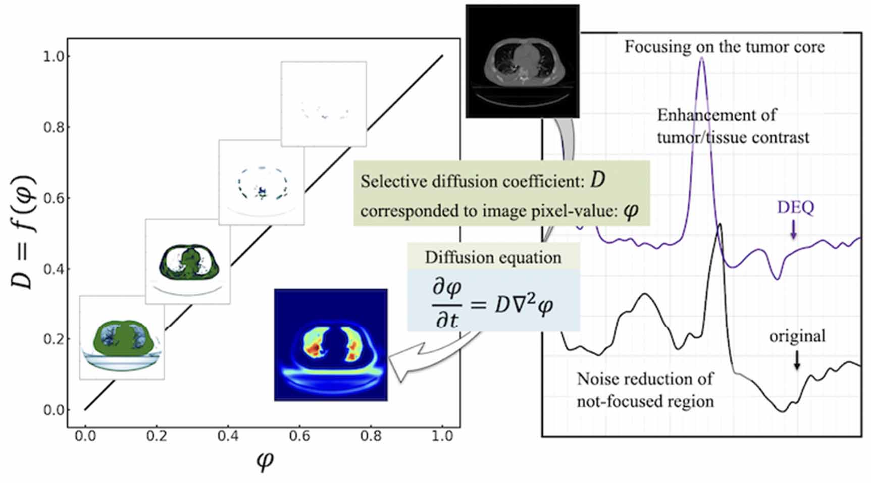 Diffusion equation quantification: selective enhancement algorithm for bone metastasis lesions ...